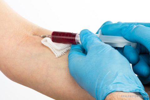 Vital Phlebotomy Basics: A Beginner’s Guide to Blood Collection and ...